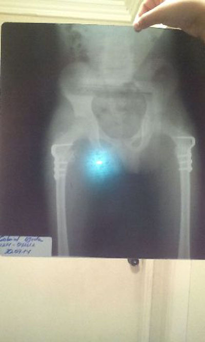 Radiografía de «Gabo» muestra rostro de José Gregorio Hernández - Qué Pasa