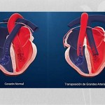 Thomás Gregorio: un niño feliz con un gran corazón - Qué Pasa